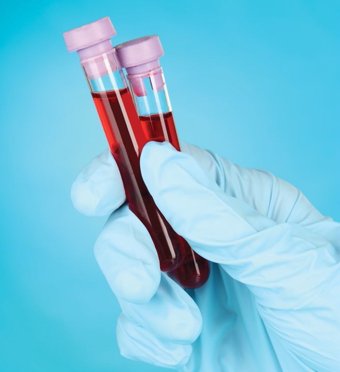 Risks and side effects of a bone marrow transplant